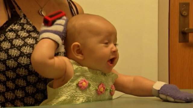 'Sticky mittens' to help babies